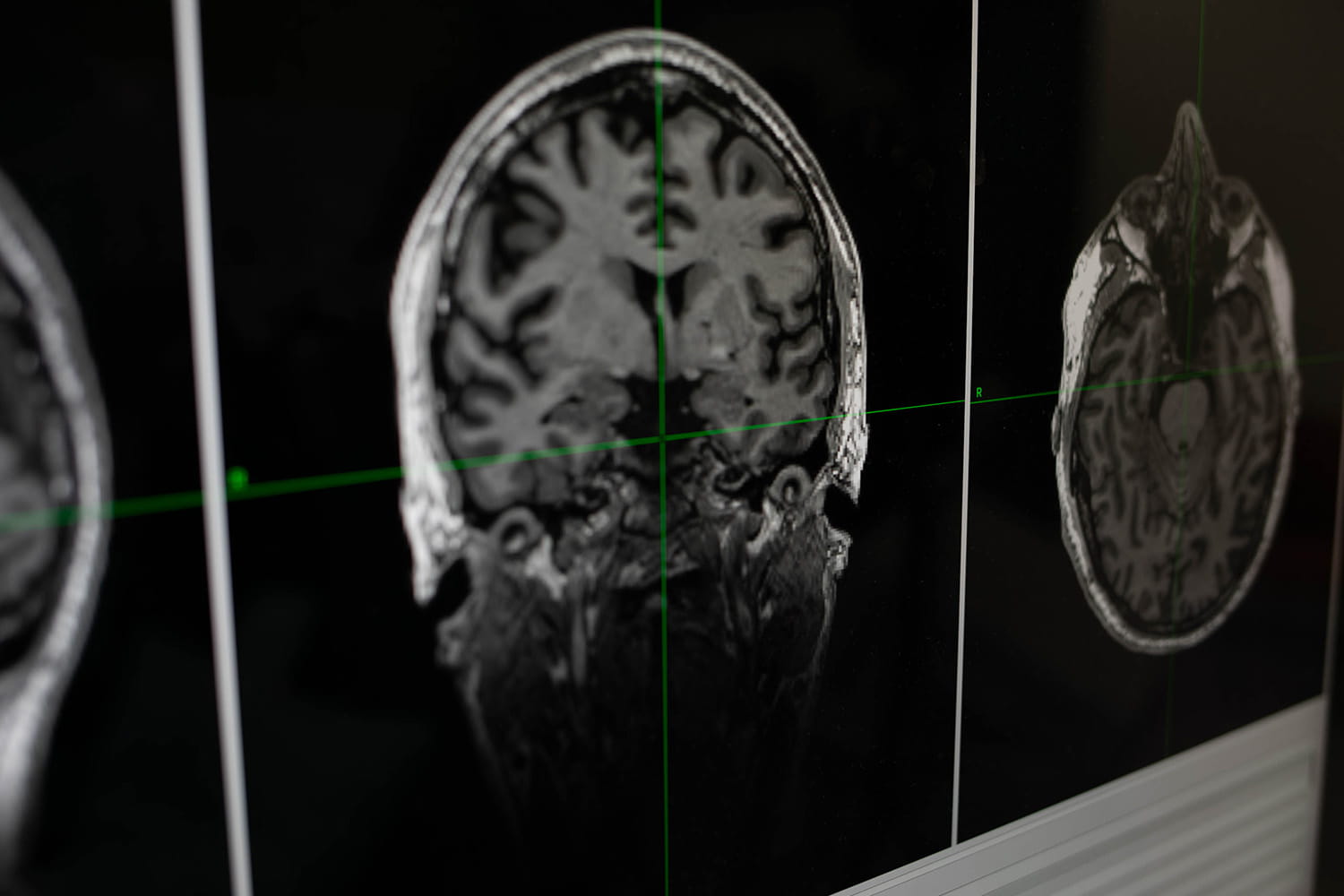 Large confirmatory clinical trial shows efficacy and safety of new ...